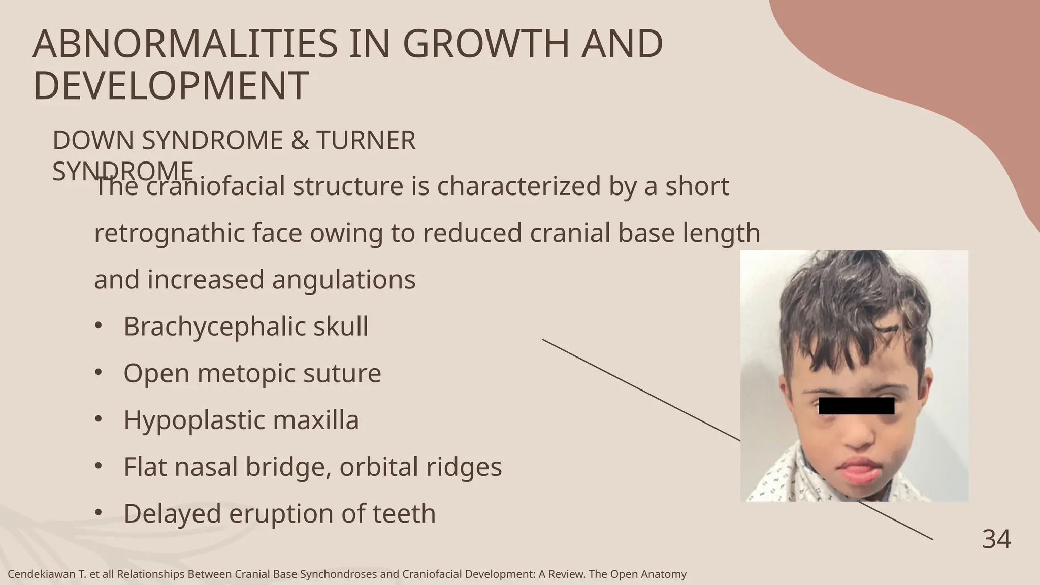 SYNCHONDROSIS IN ORTHODONTICS AND ITS SIGNIFICANCE IN GROWTH | PPTX