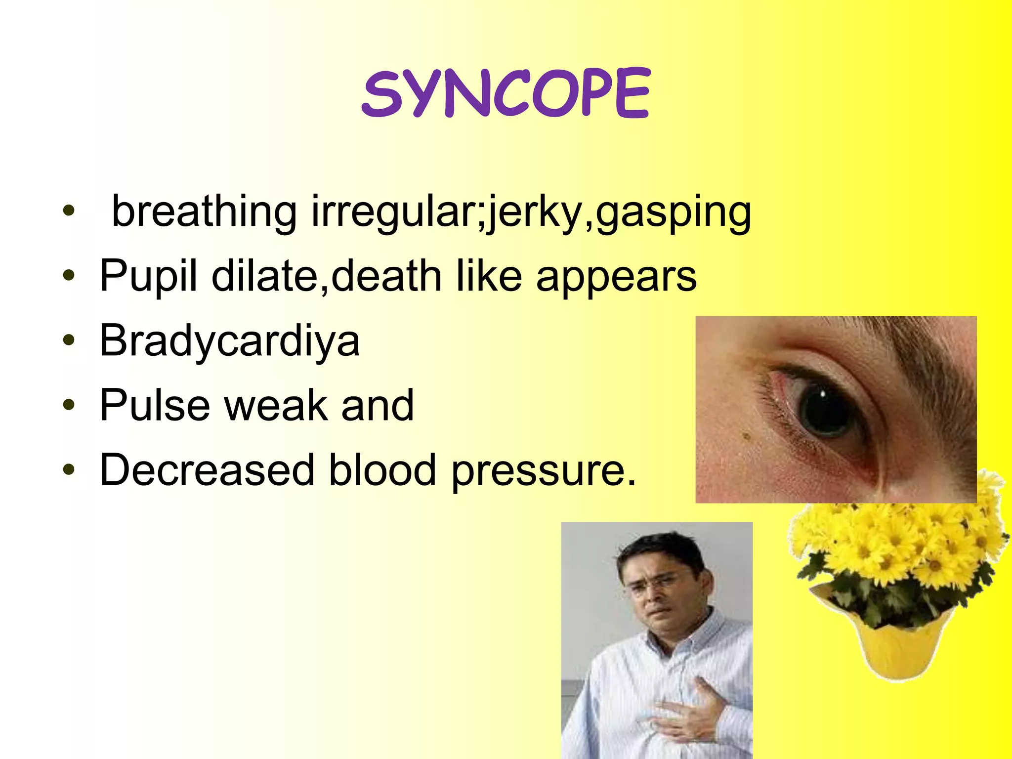 Syncope | PPTX