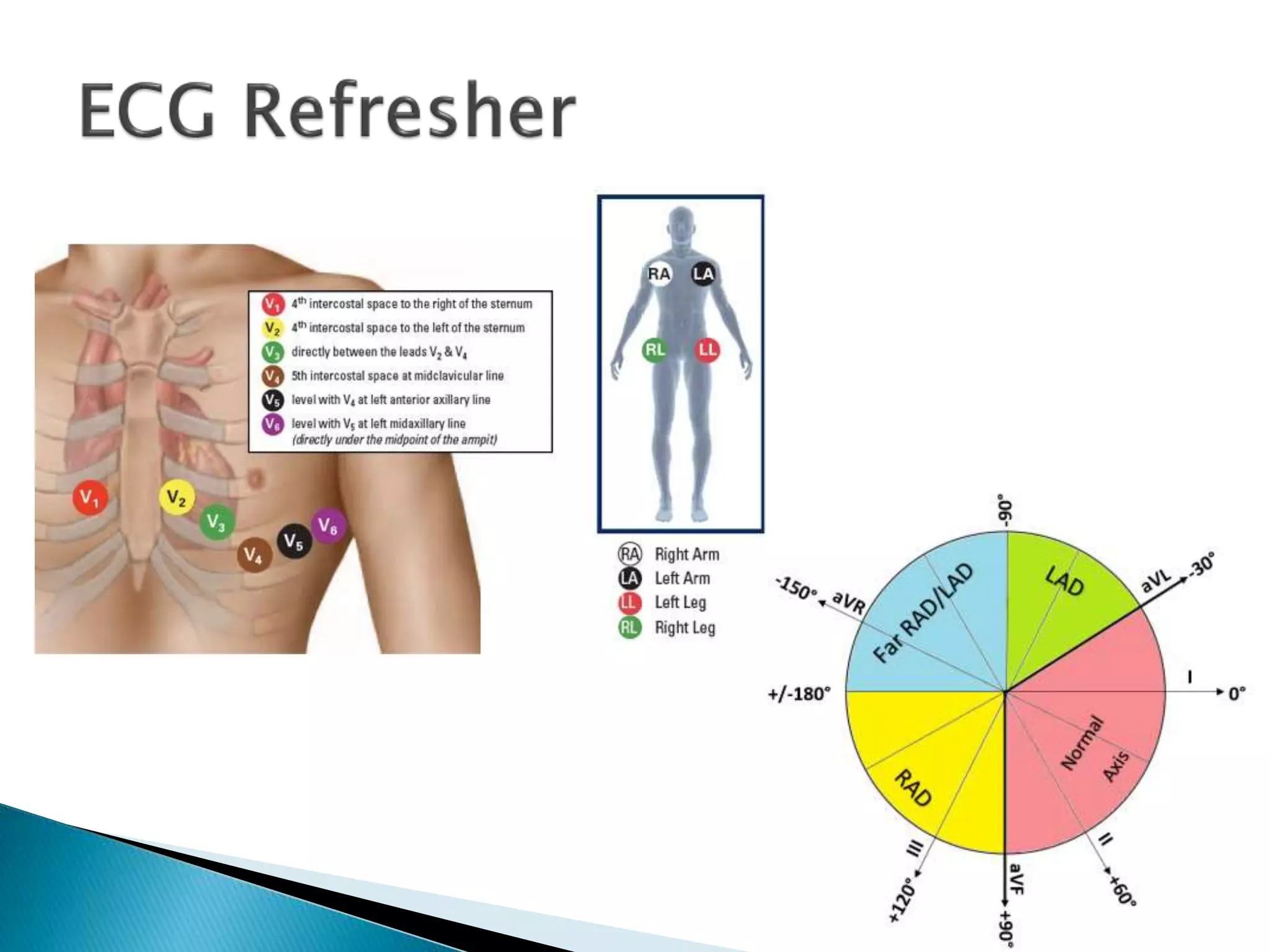Syncope and the ECG | PPT