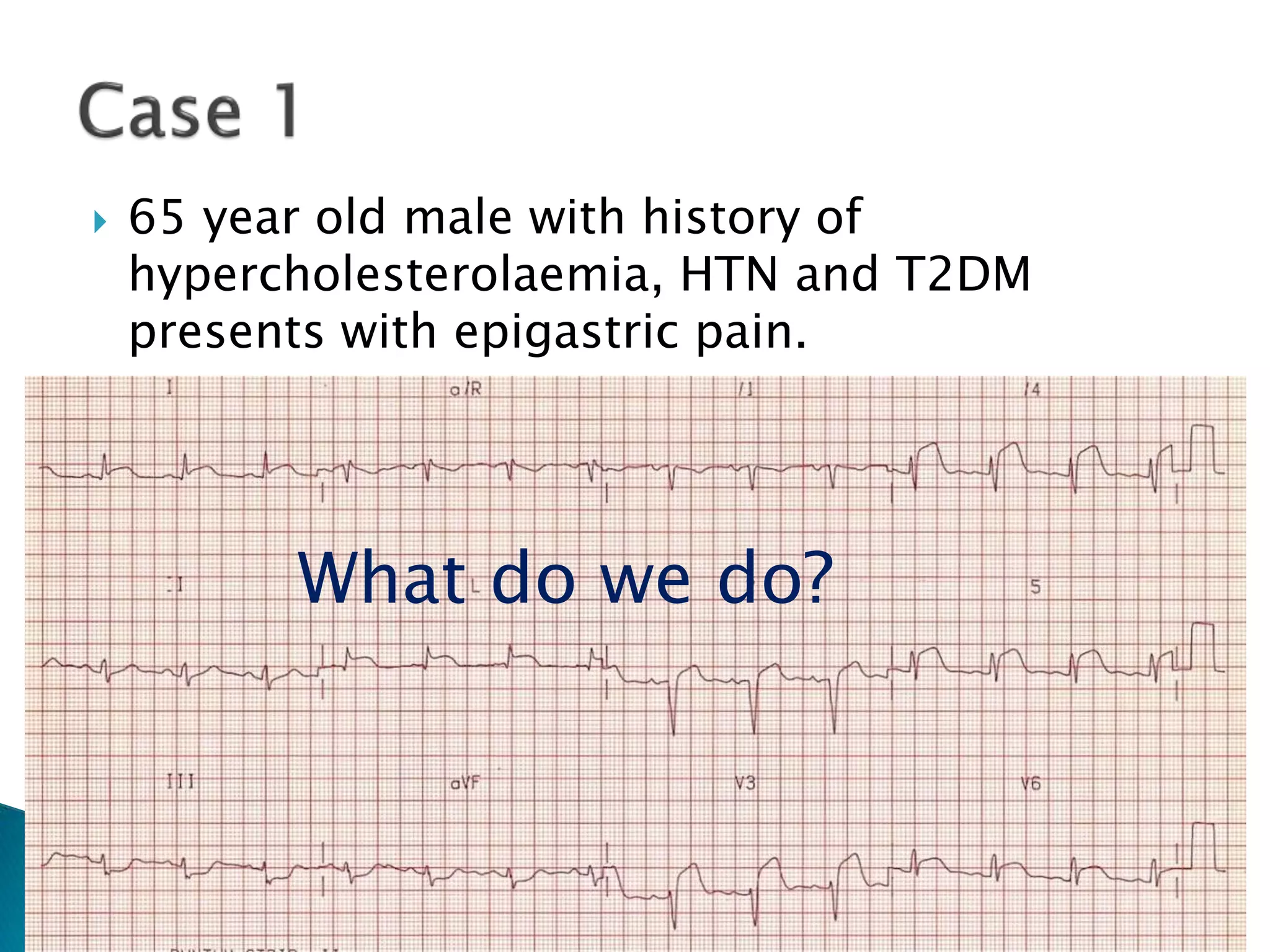 Syncope and the ECG | PPT