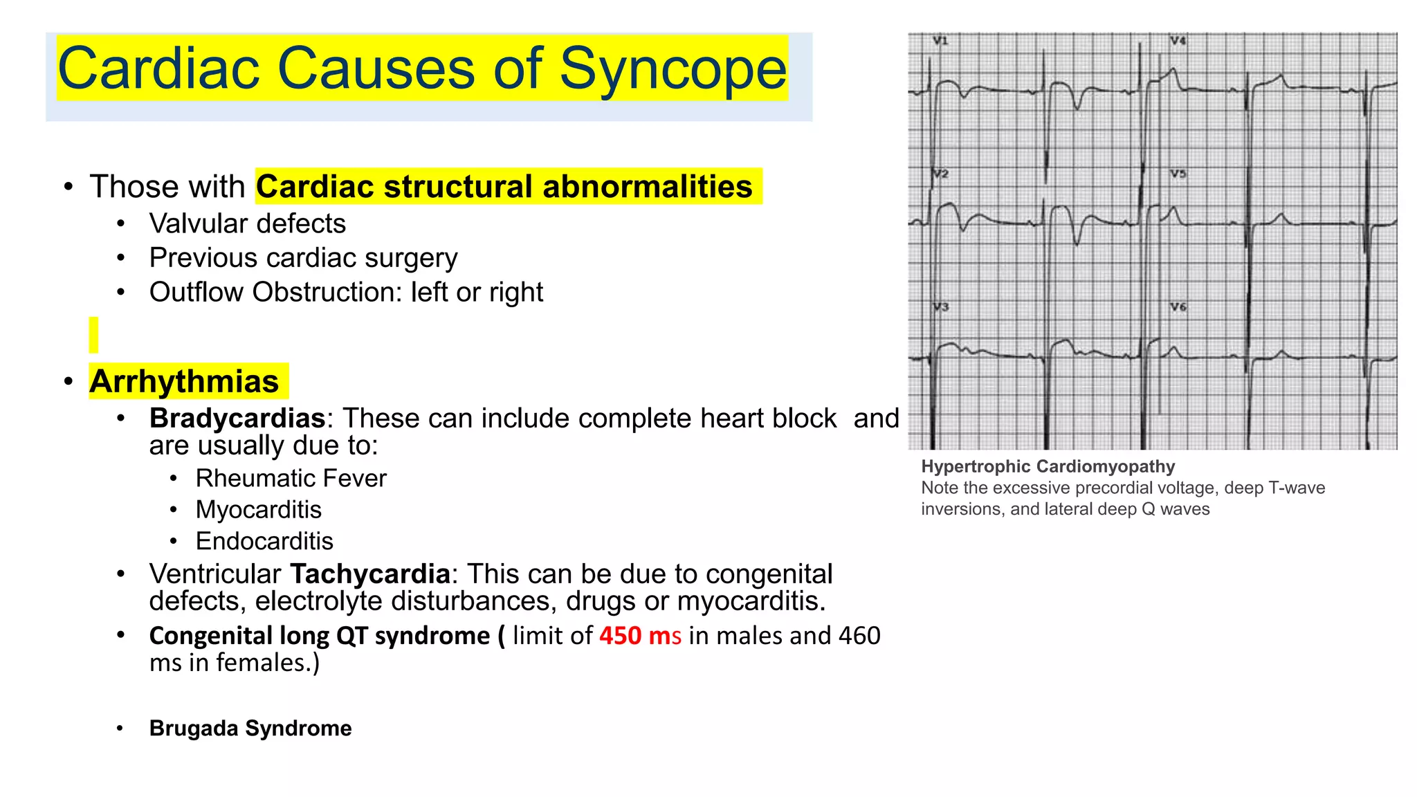 Syncope in children and adolescents | PPTX