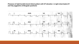 Syncope in pediatrics | PPT