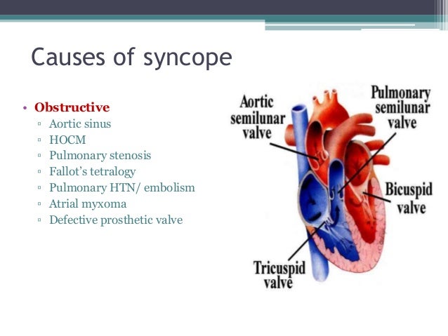 Syncope Presentation