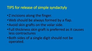 Syndactyly | PPTX