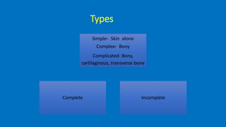 Syndactyly | PPTX