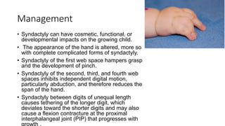 Syndactyly Hand | PPTX