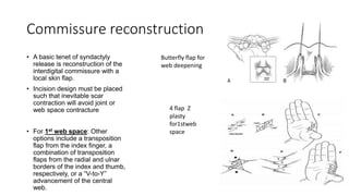 Syndactyly Hand | PPTX