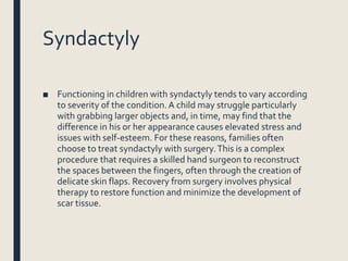 Syndactyly - A Basic Introduction | PPTX