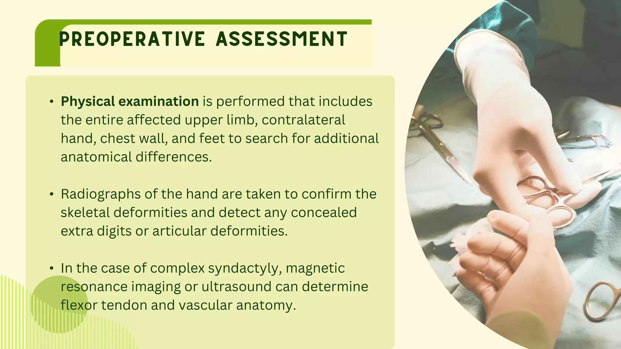 SYNDACTYLY RELEASE..pptx