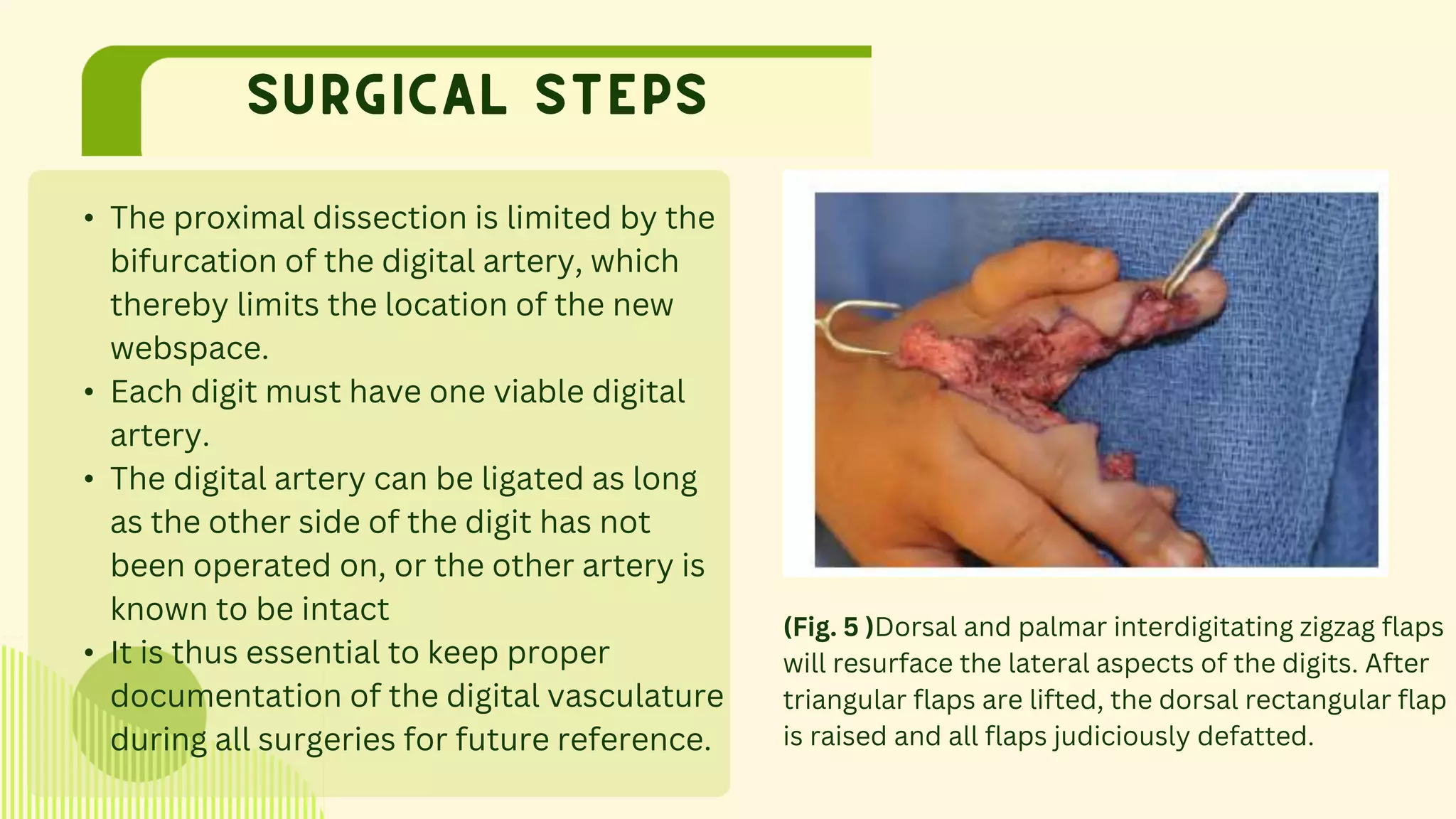 SYNDACTYLY RELEASE..pptx