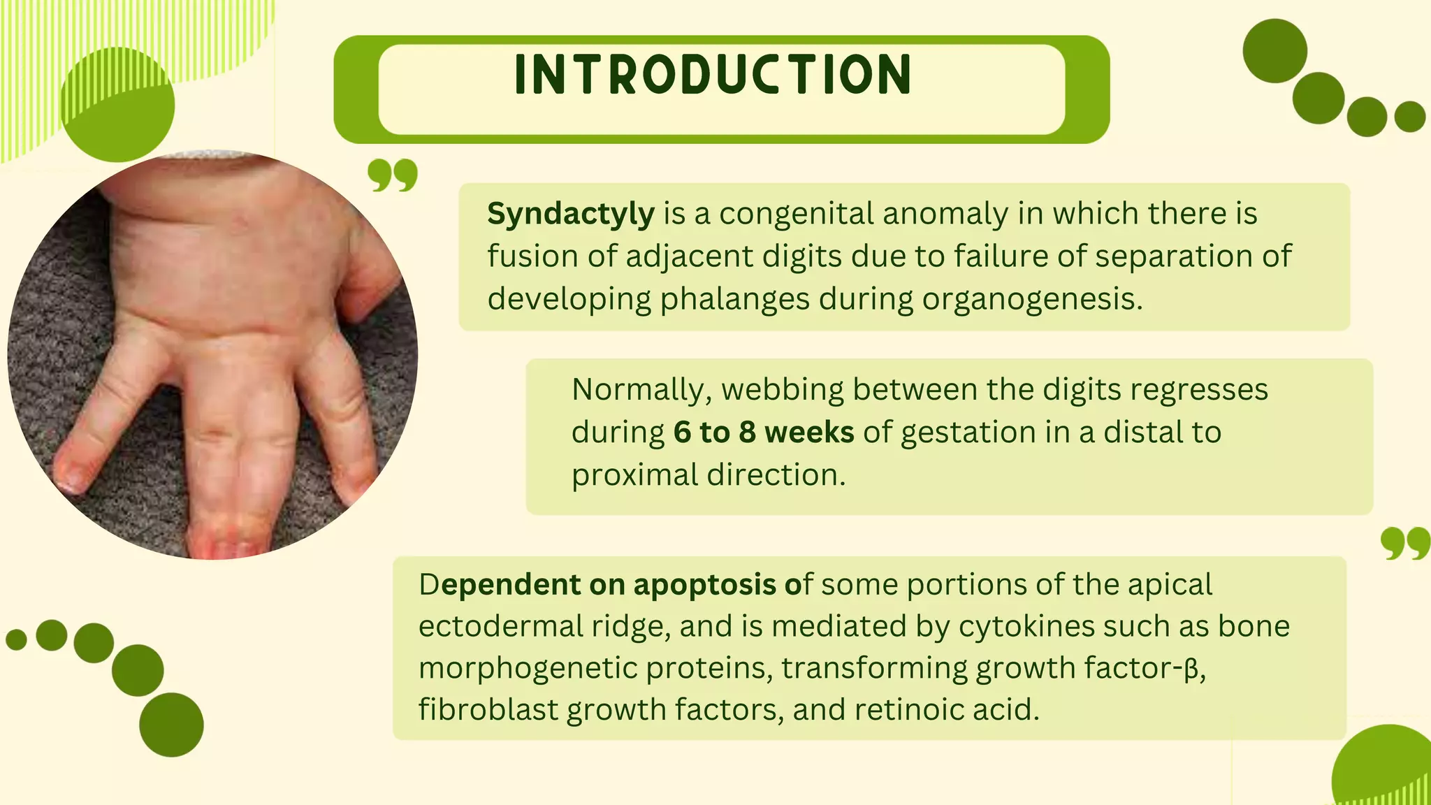 SYNDACTYLY RELEASE..pptx