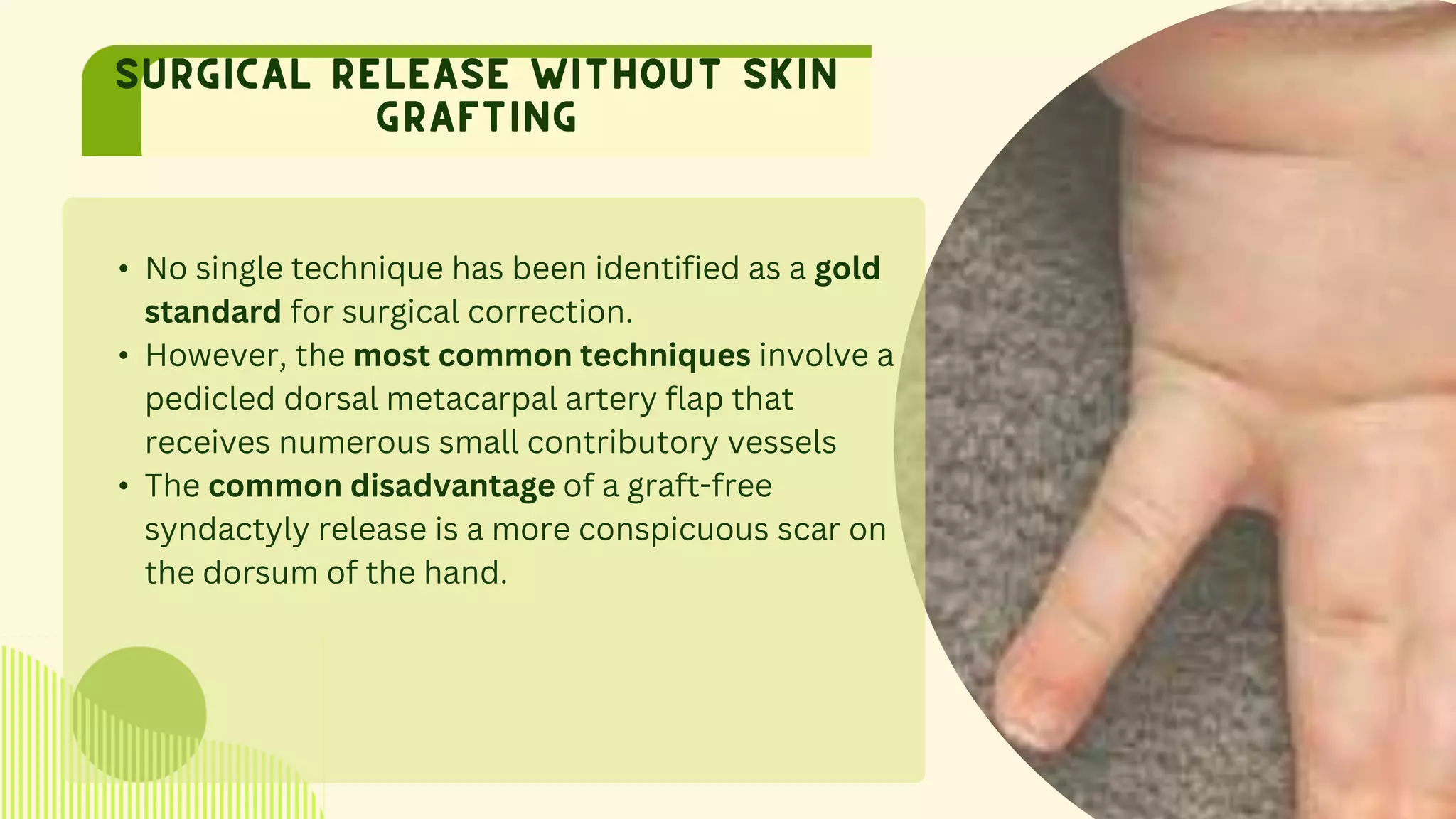 SYNDACTYLY RELEASE..pptx