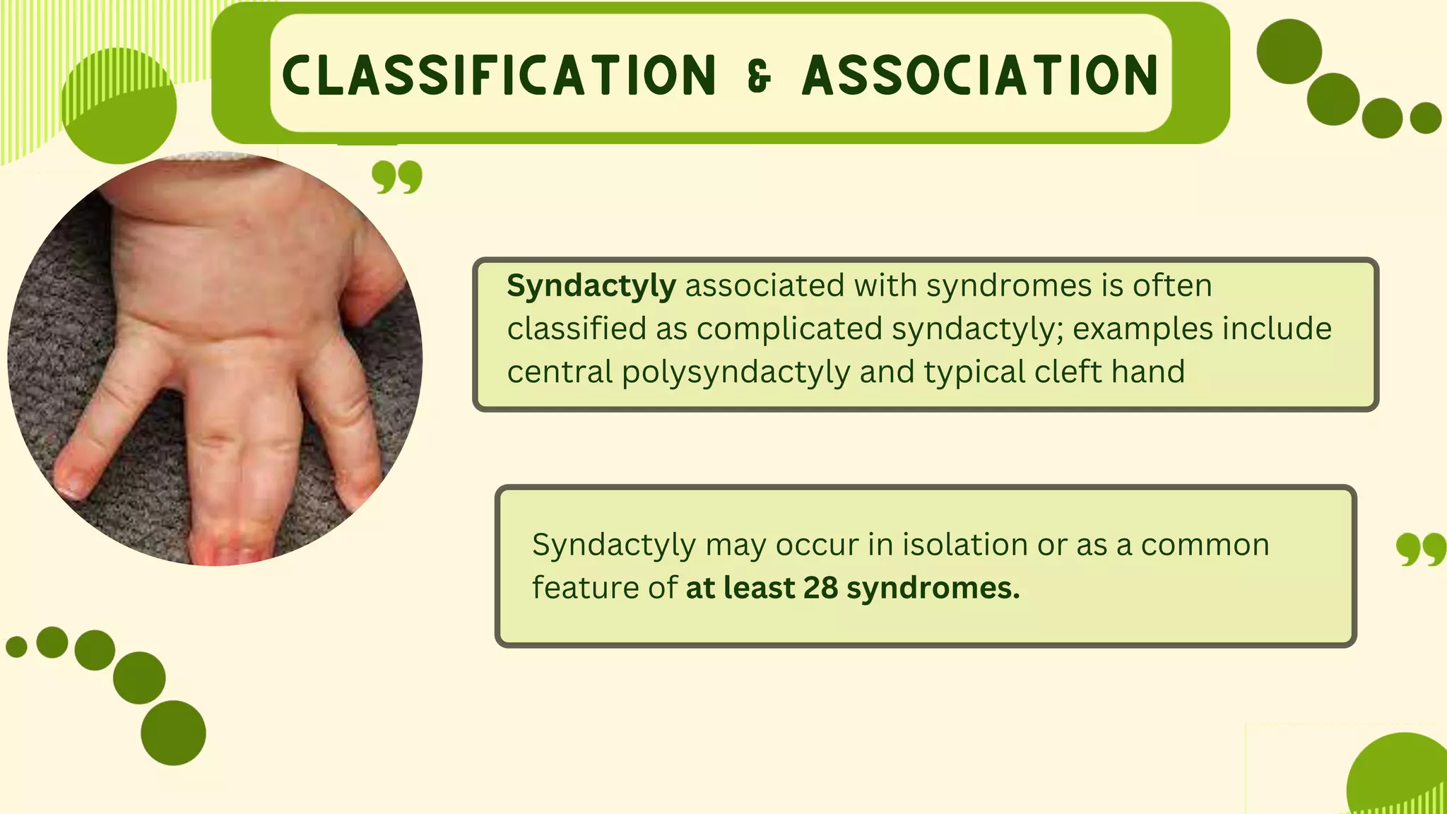 SYNDACTYLY RELEASE..pptx
