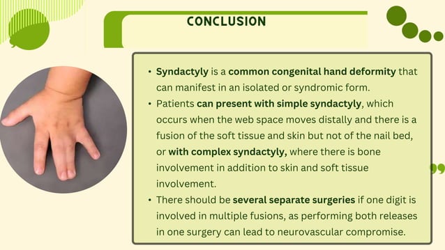 SYNDACTYLY RELEASE..pptx