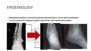 SYNDESMOTIC INJURY- ANATOMICAL REPAIR.pptx