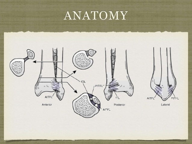 syndesmotic injury mechanism and treatment subject review | PPT
