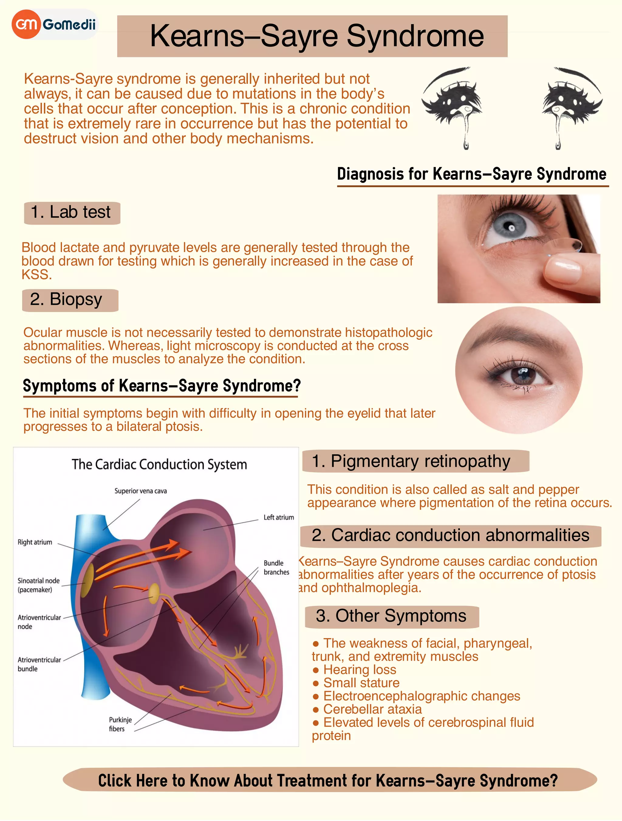 Kearns–Sayre Syndrome: Symptoms, Causes, Diagnosis, and Treatment | PDF