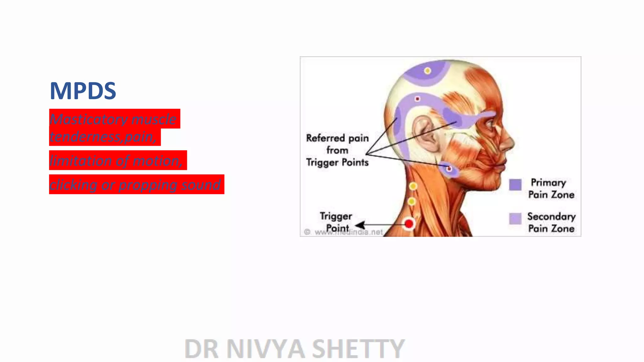 Syndromes of head neck face | PPTX