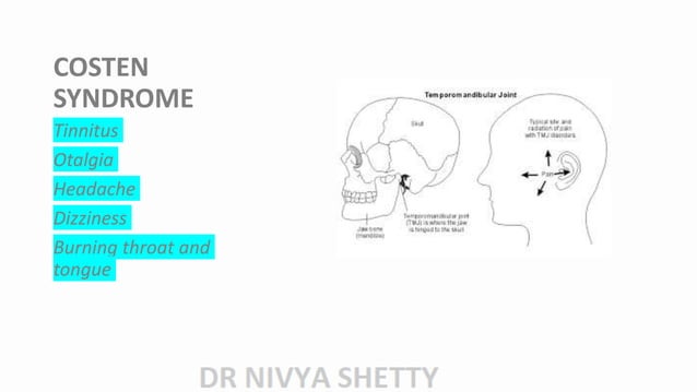 Syndromes of head neck face | PPTX | Dental Health | Diseases and ...