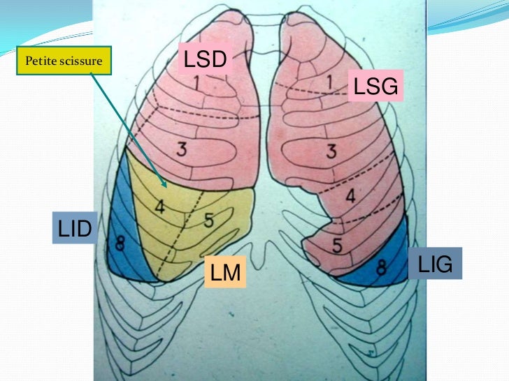 Syndrome de condensation pulmonaire