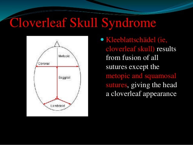 Syndromes of Head & Neck