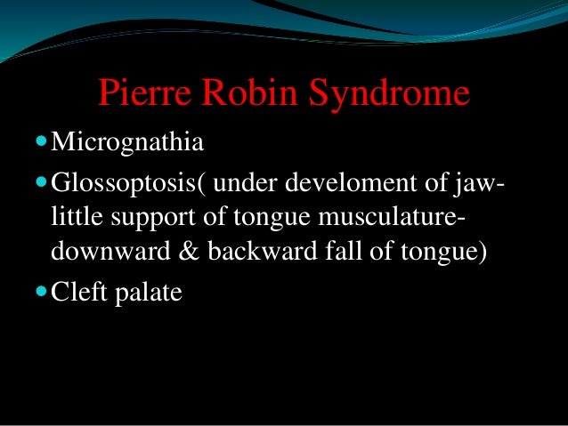 Syndromes of Head & Neck