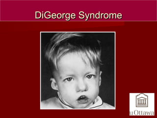 Syndromes | PPT