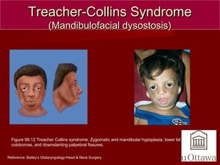Syndromes | PPT