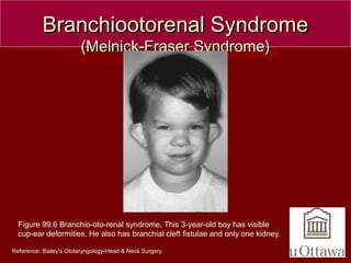 Syndromes | PPT