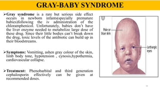 Syndromes and it's Treatments | PPT