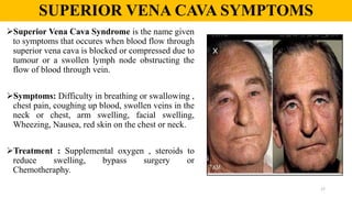 Syndromes and it's Treatments | PPT