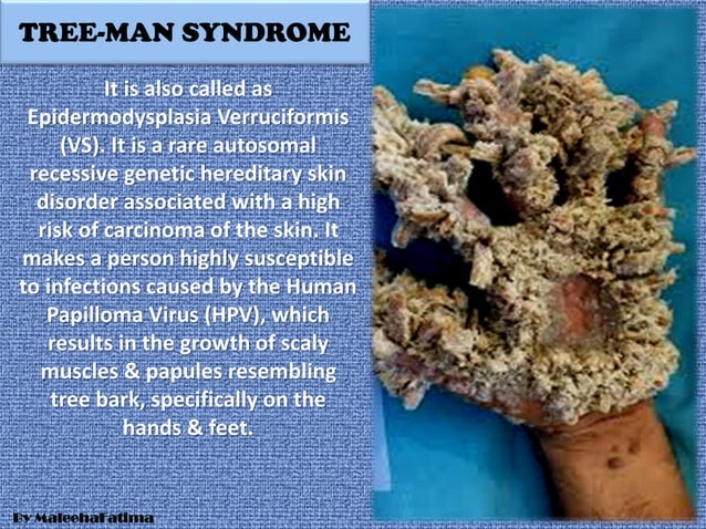 SYNDROMES | PPT