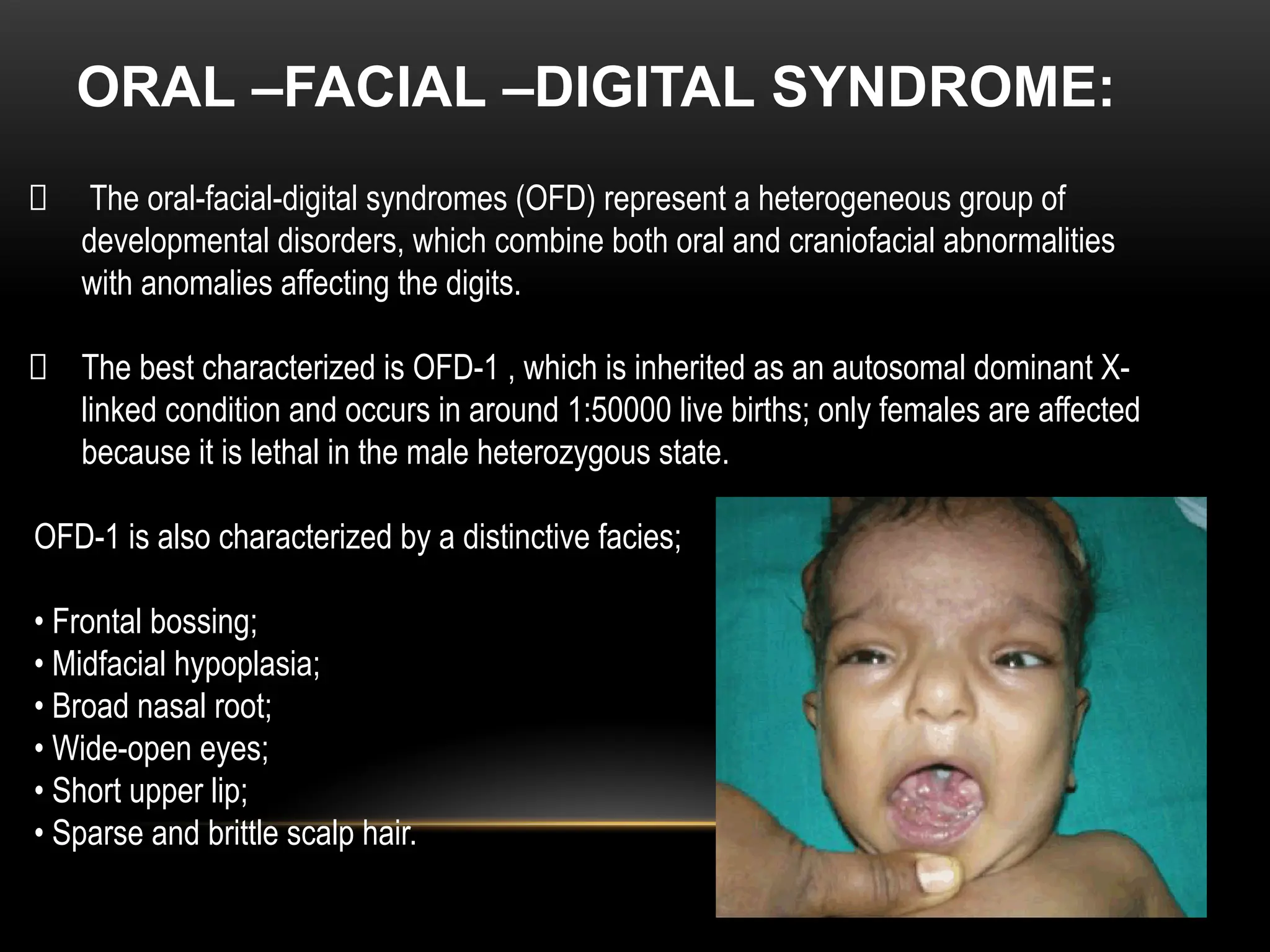 Syndromes affecting the craniofacial region.pdf