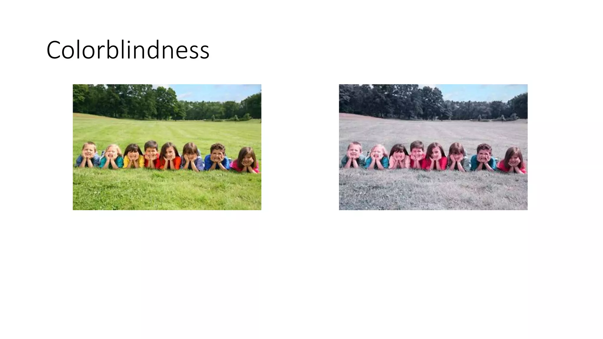 syndromes of humans.pptx