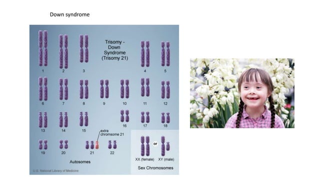 syndromes of humans.pptx
