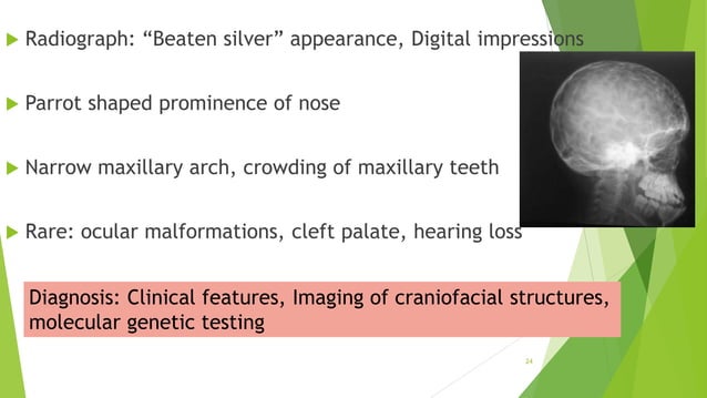 Syndromes of orofacial region mine | PPTX | Ear, Nose and Throat ...