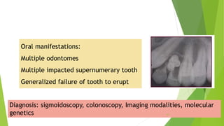 Syndromes of orofacial region mine | PPTX