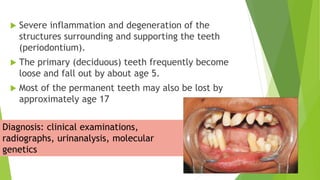 Syndromes of orofacial region mine | PPTX