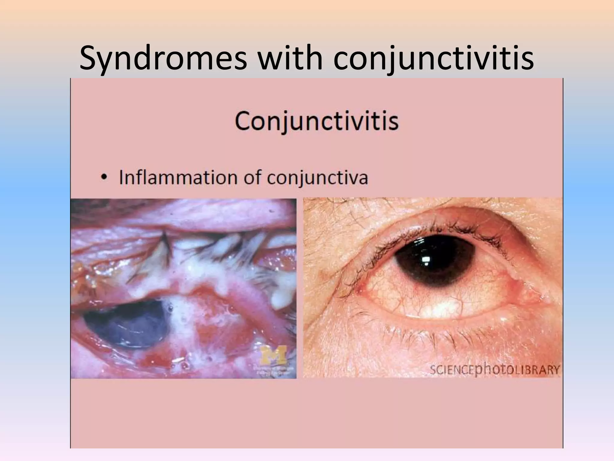 Syndromic approach in diagnostic virology | PPTX