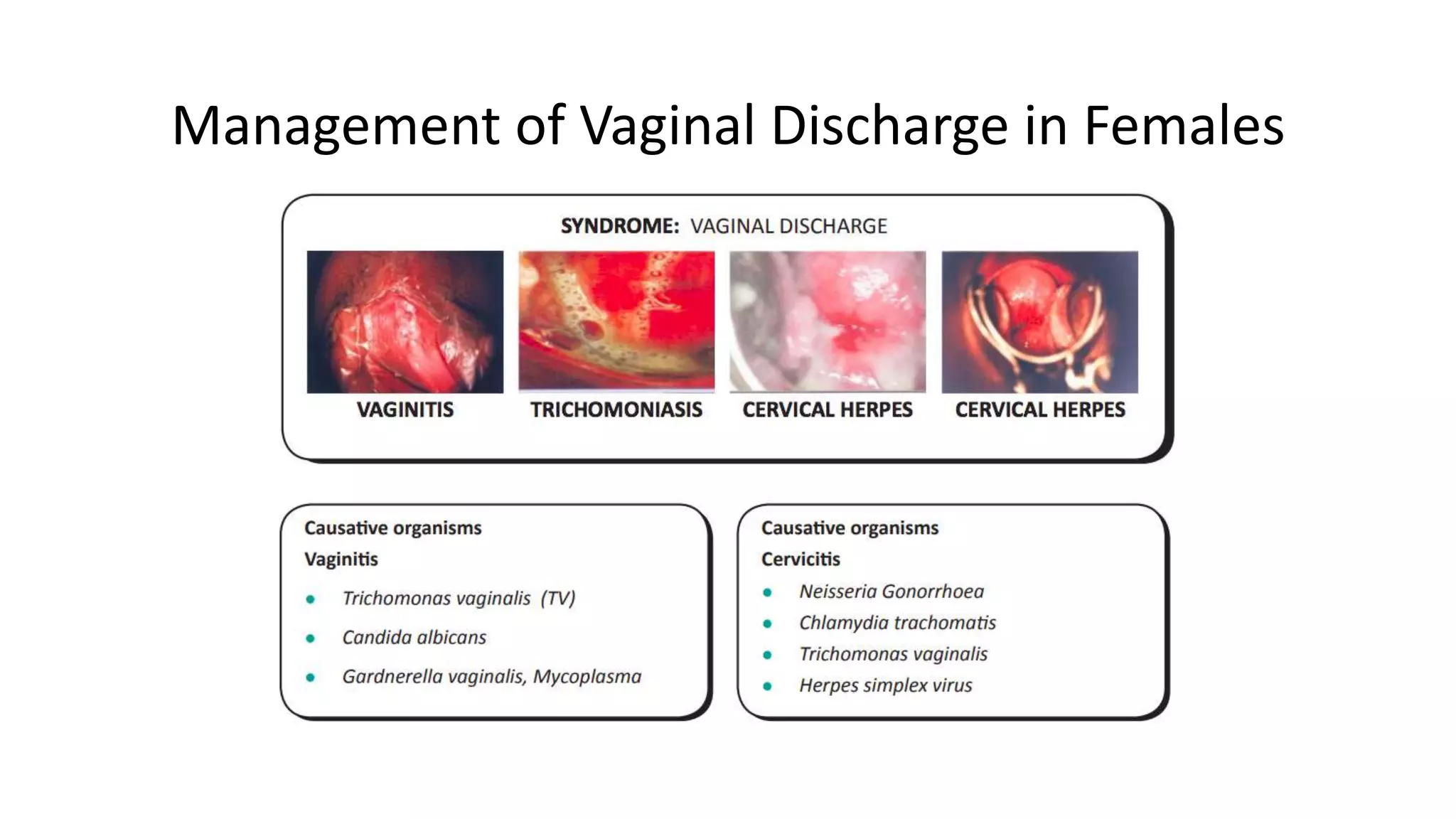 SYNDROMIC APPROACH TO VAGINAL DISCHARGE (1).pptx | Sexual Conditions ...