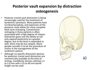 Syndromic cranial synostosis | PPTX