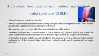 Syndromic Ichthyosis and it's management | PPTX