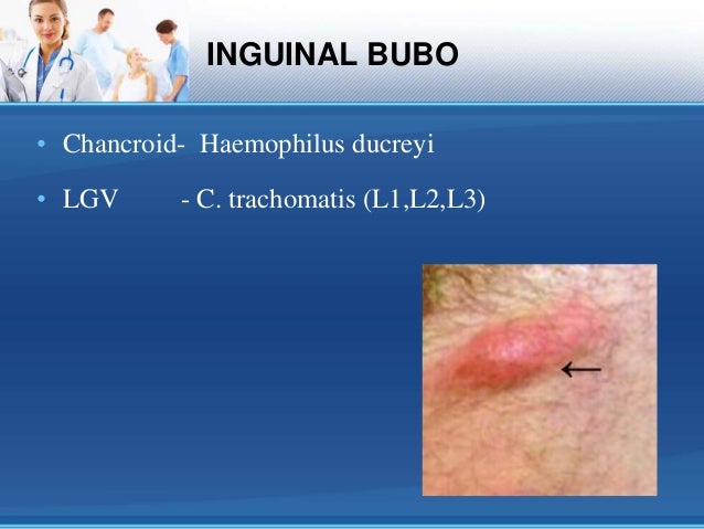 Syndromic management of STD's