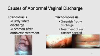 Syndromic management of sti's | PPTX