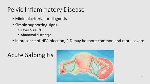 Syndromic management of sti's | PPTX | Sexual Conditions | Sexual Health