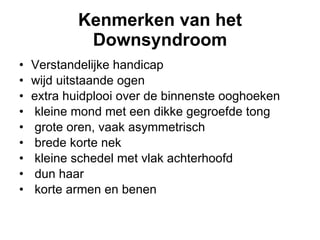 Syndroom Van Down | PPT