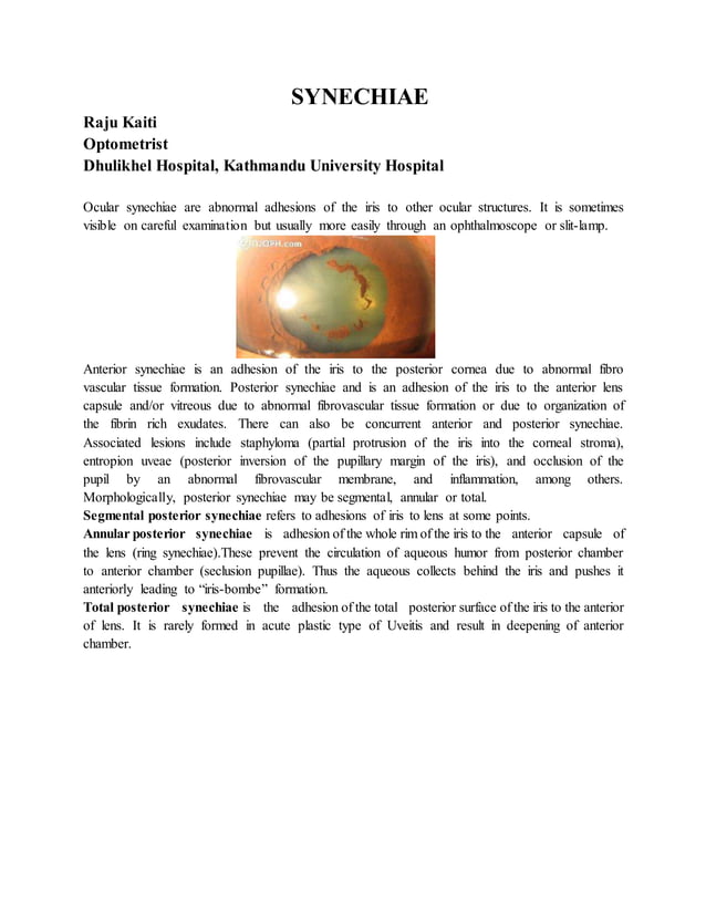 Synechia | DOCX