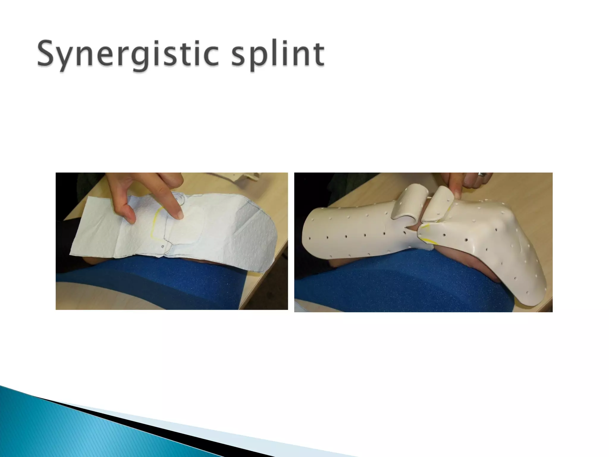synergist splint for flexor tendon repair | PPT