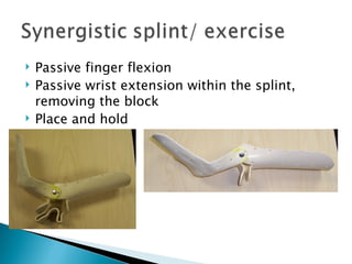 synergist splint for flexor tendon repair | PPT