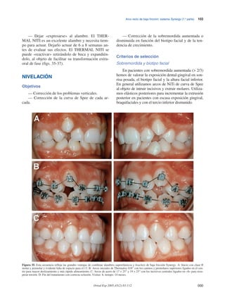 brackets Synergy swlf | PDF